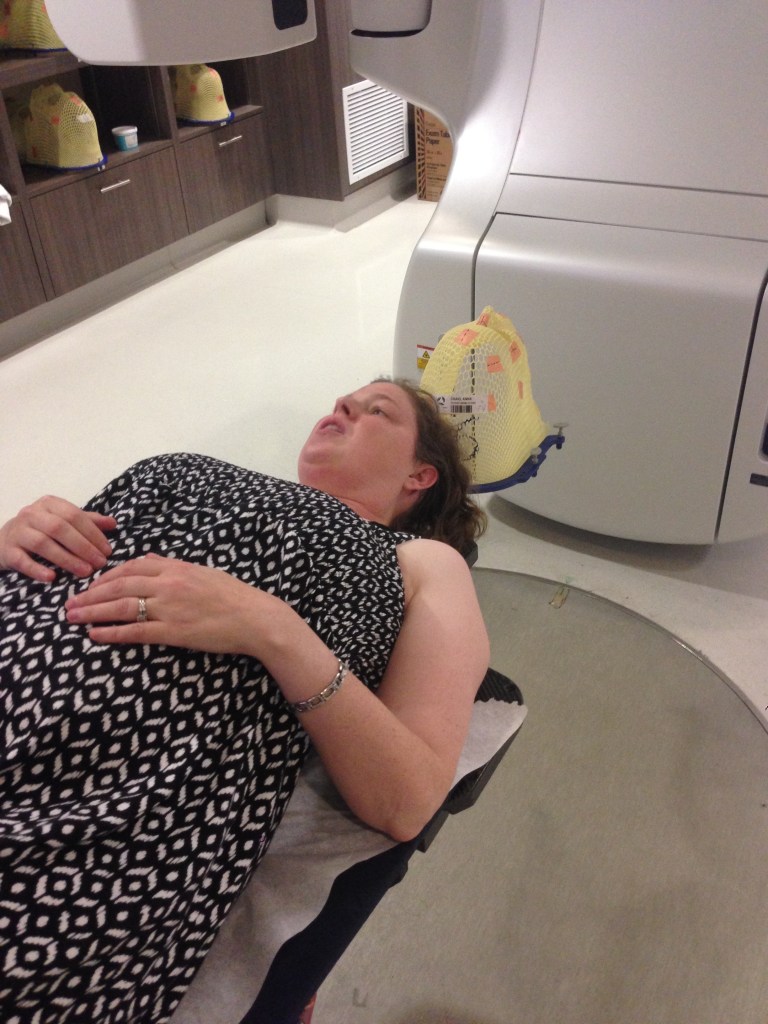 Whole Brain Radiation – Anna Craig